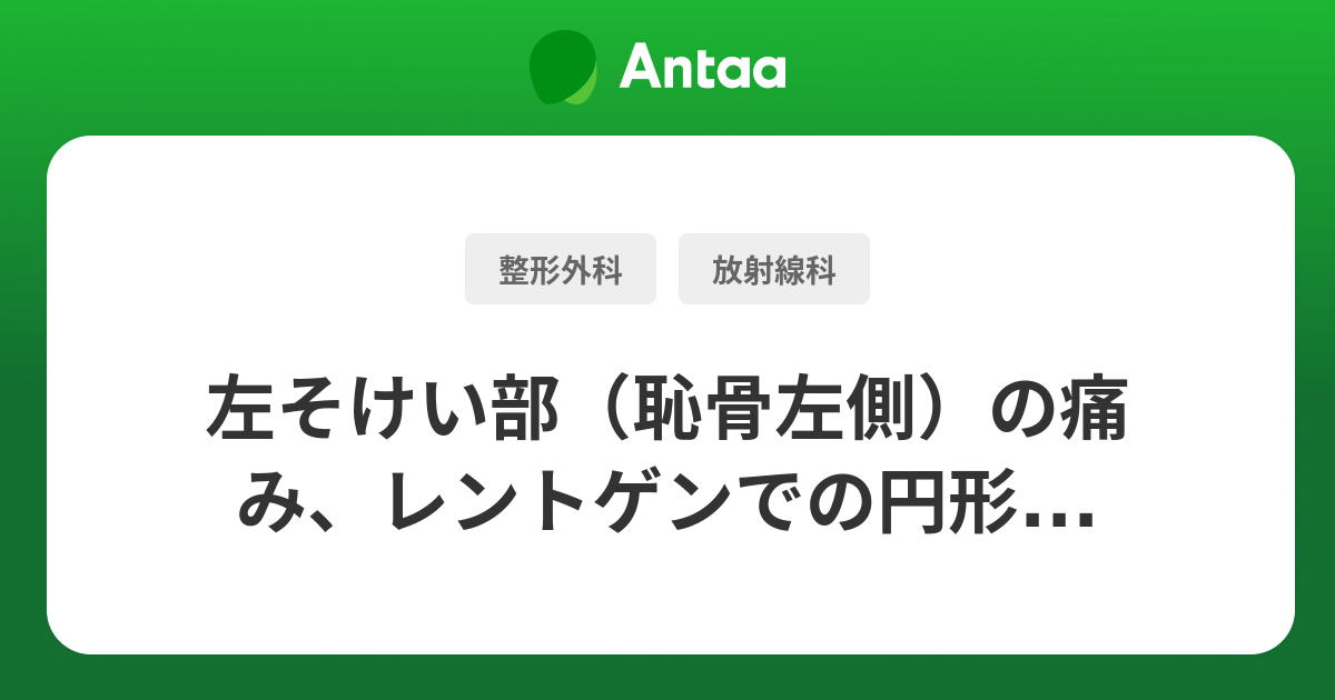 Antaa QA